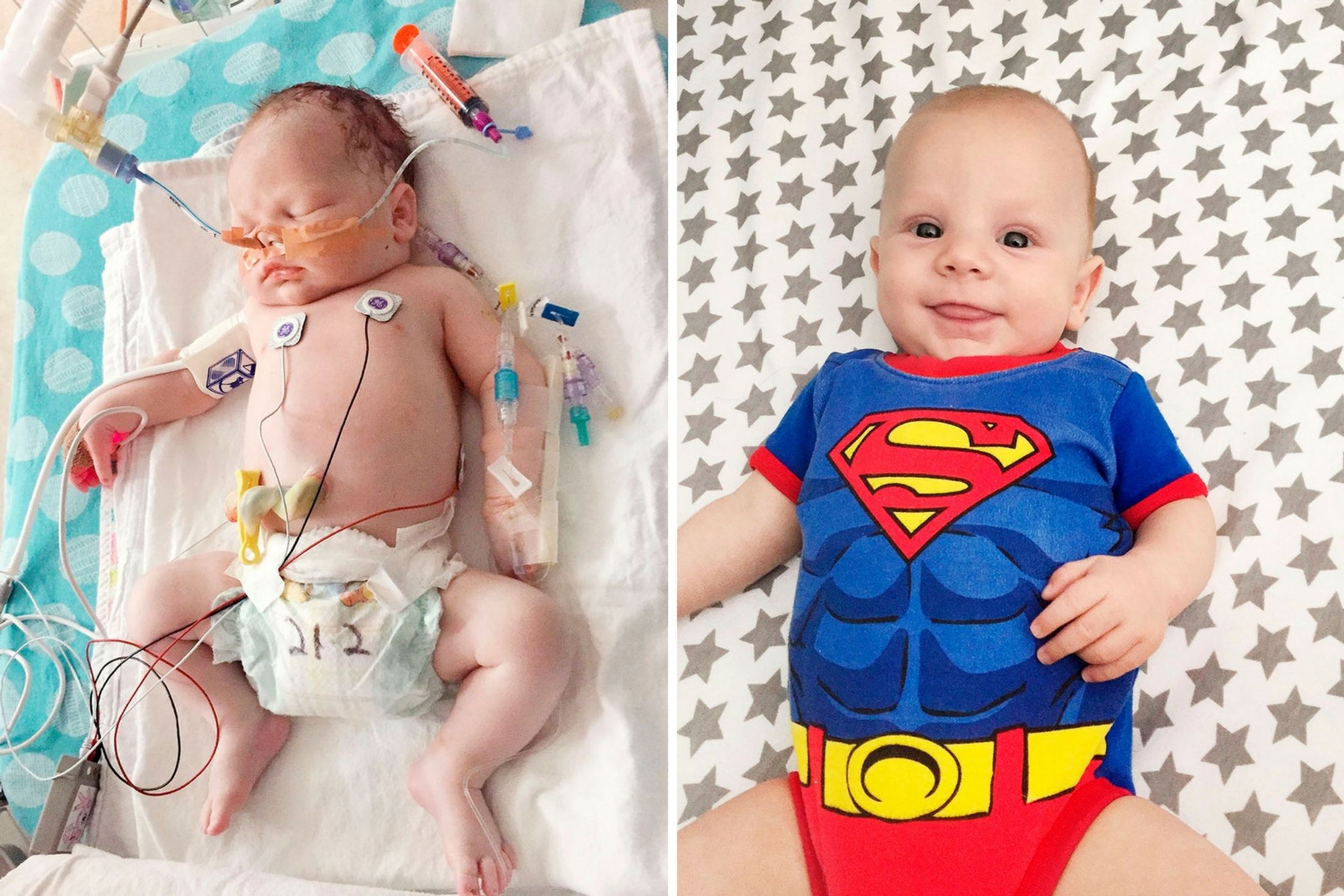 Newborn baby born with congenital fibrosarcoma cancer | that's life!