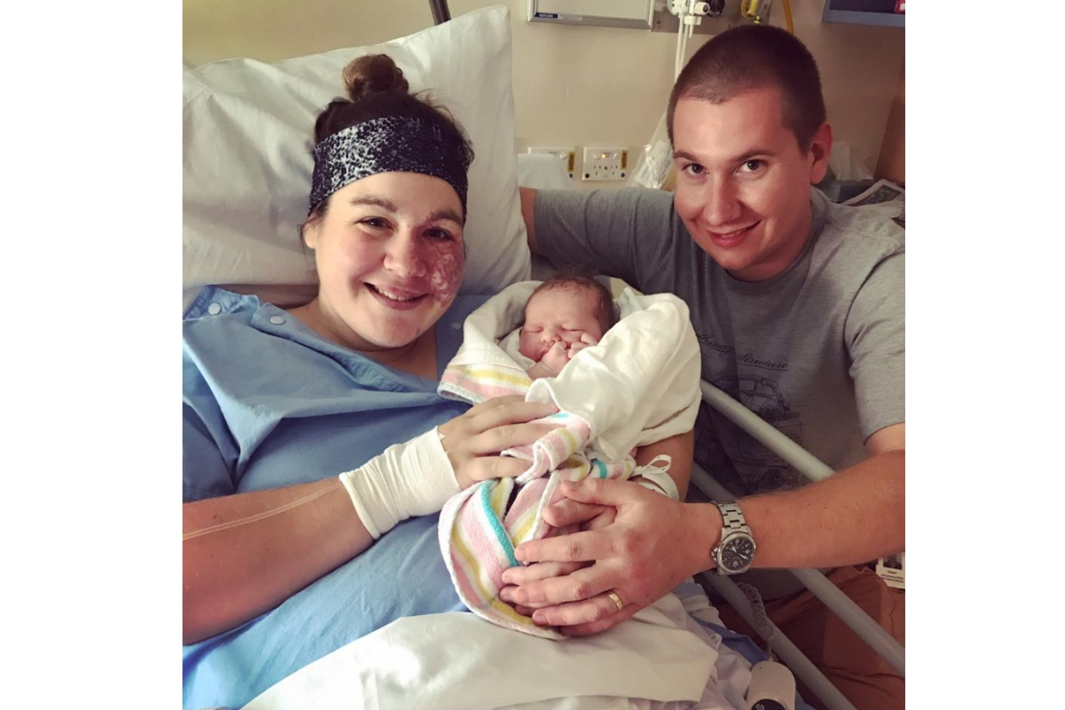 Adelaide mum Kristen Weber-Moll born with port wine stain is proud of ...