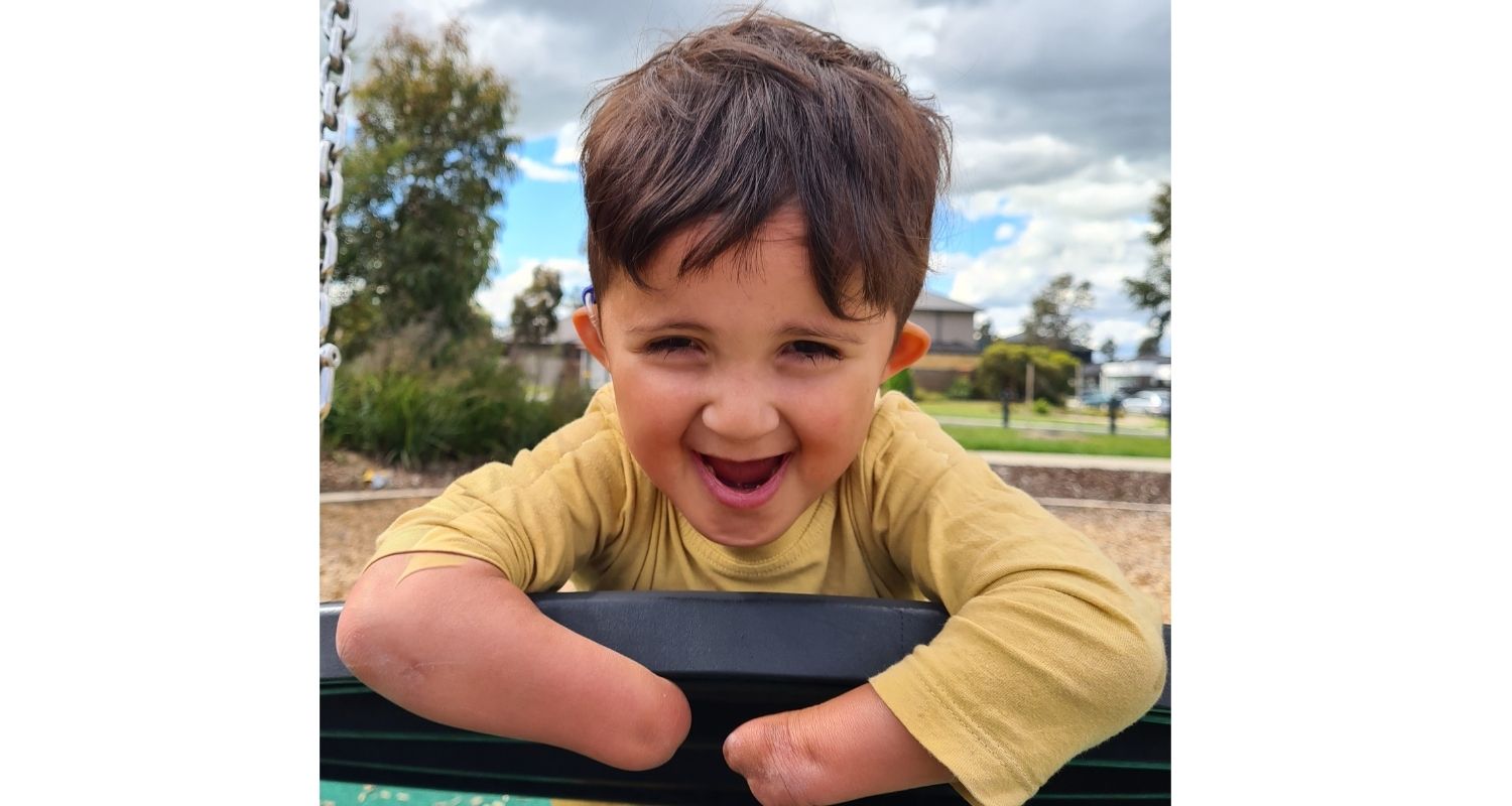 Inspiring story: 'Born with no hands - but nothing will stop my boy ...