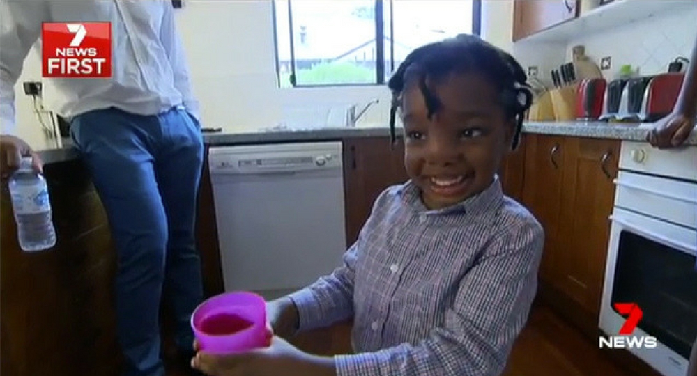 Baby born with his brain outside his skull has incredible ...